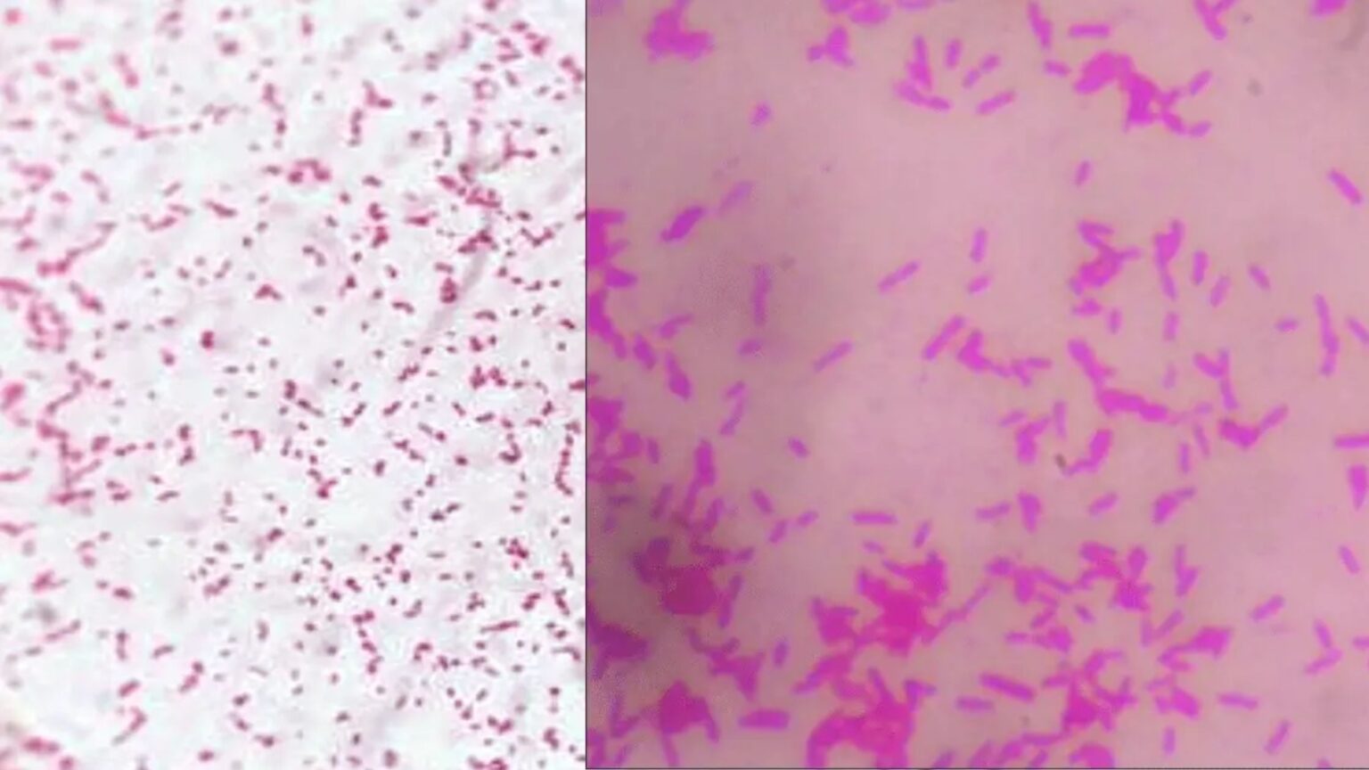 Pseudomonas Aeruginosa Under Microscope (Gram Staining) - Biology Notes ...