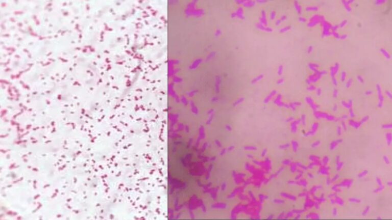Onion Cells Under a Microscope - Biology Notes Online Onion Cells Under a Microscope - Biology Notes Online
