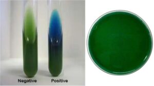 Cetrimide Agar - Composition, Principle, Preparation, Results, Uses ...