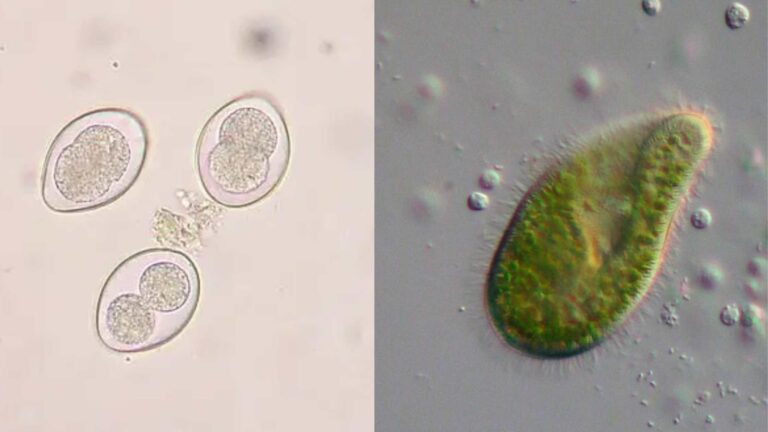 Classification of Protozoa - Biology Notes Online