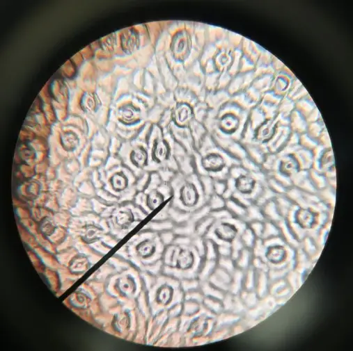 Stomata Mikroskop Stomata Under Microscope Temporary Mount Technique