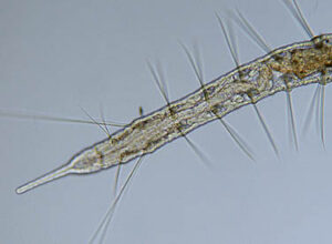 A Worm Under a Microscope - Biology Notes Online