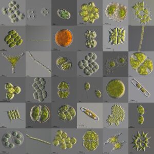 Algae Under Microscope - Biology Notes Online
