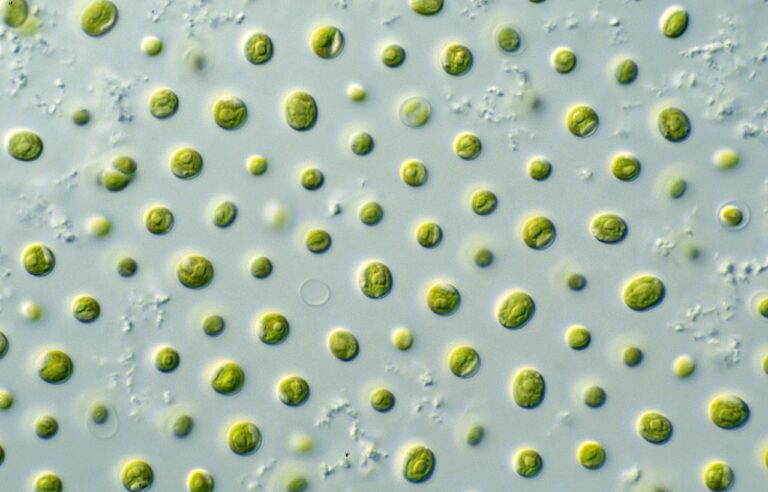 Algae Under Microscope - Biology Notes Online