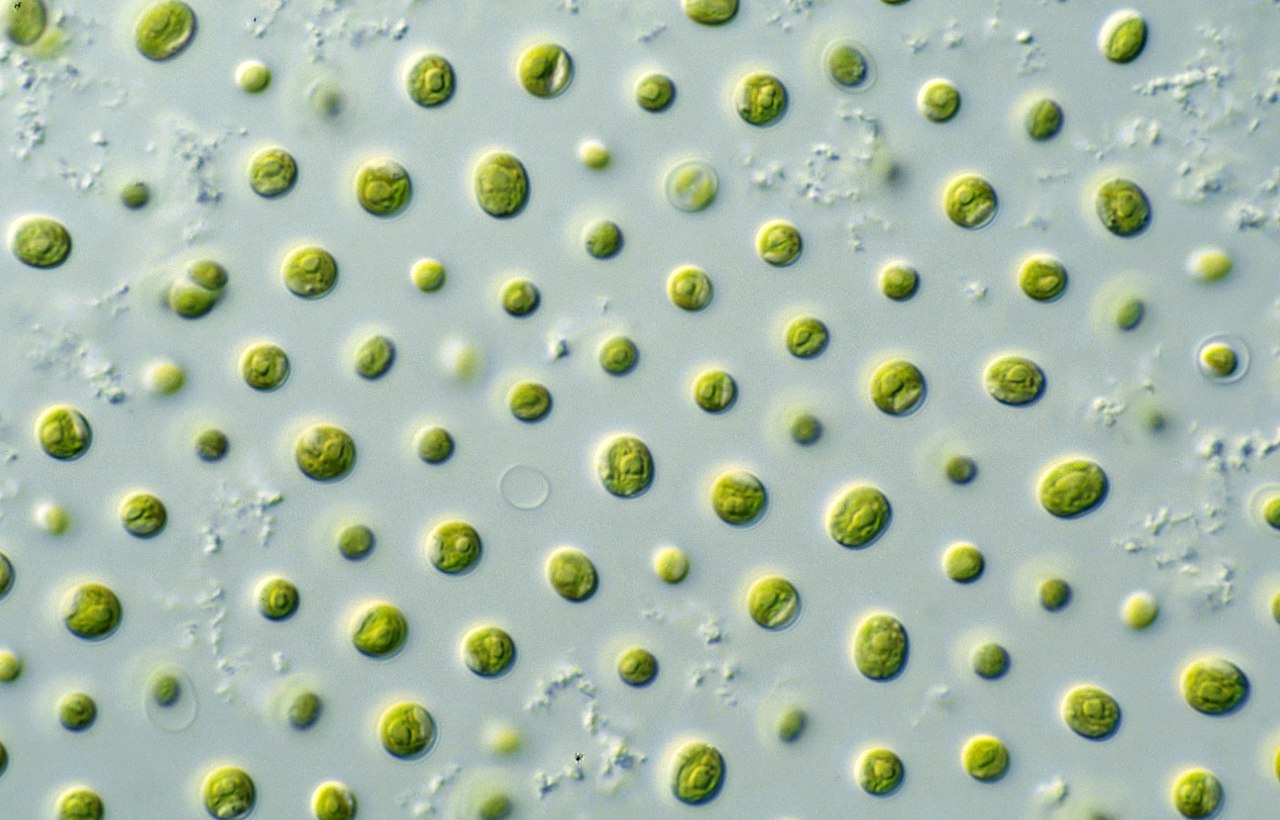 Algae Under Microscope - Biology Notes Online