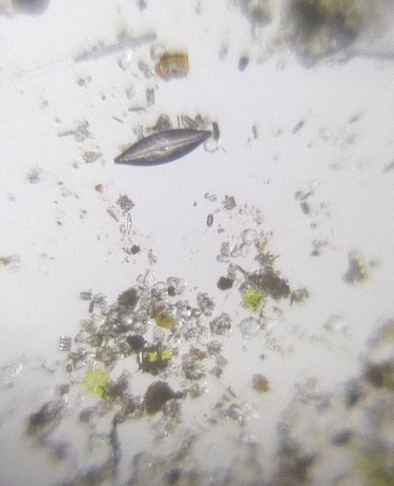 Diatoms Under the Microscope - Biology Notes Online
