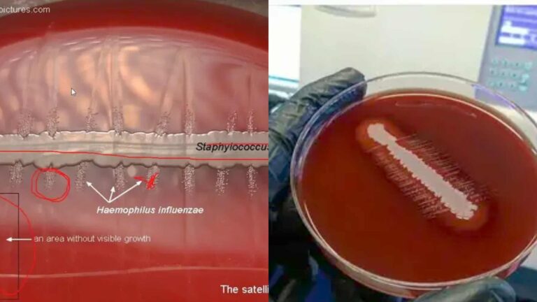 Quantitative Buffy Coat Test (QBC Test) - Biology Notes Online
