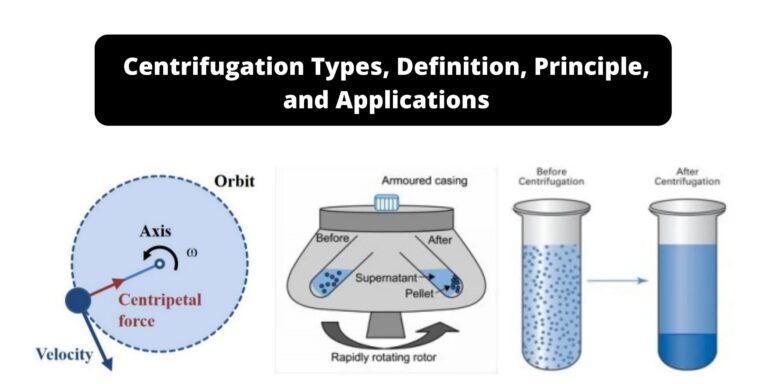 GasPak Anaerobic System - Principle, Parts, Application - Biology Notes ...