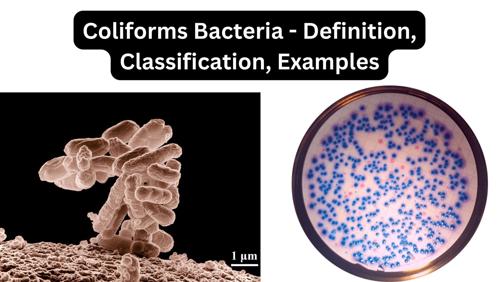 Gram Negative bacteria - Definition, Structure, Characteristics ...