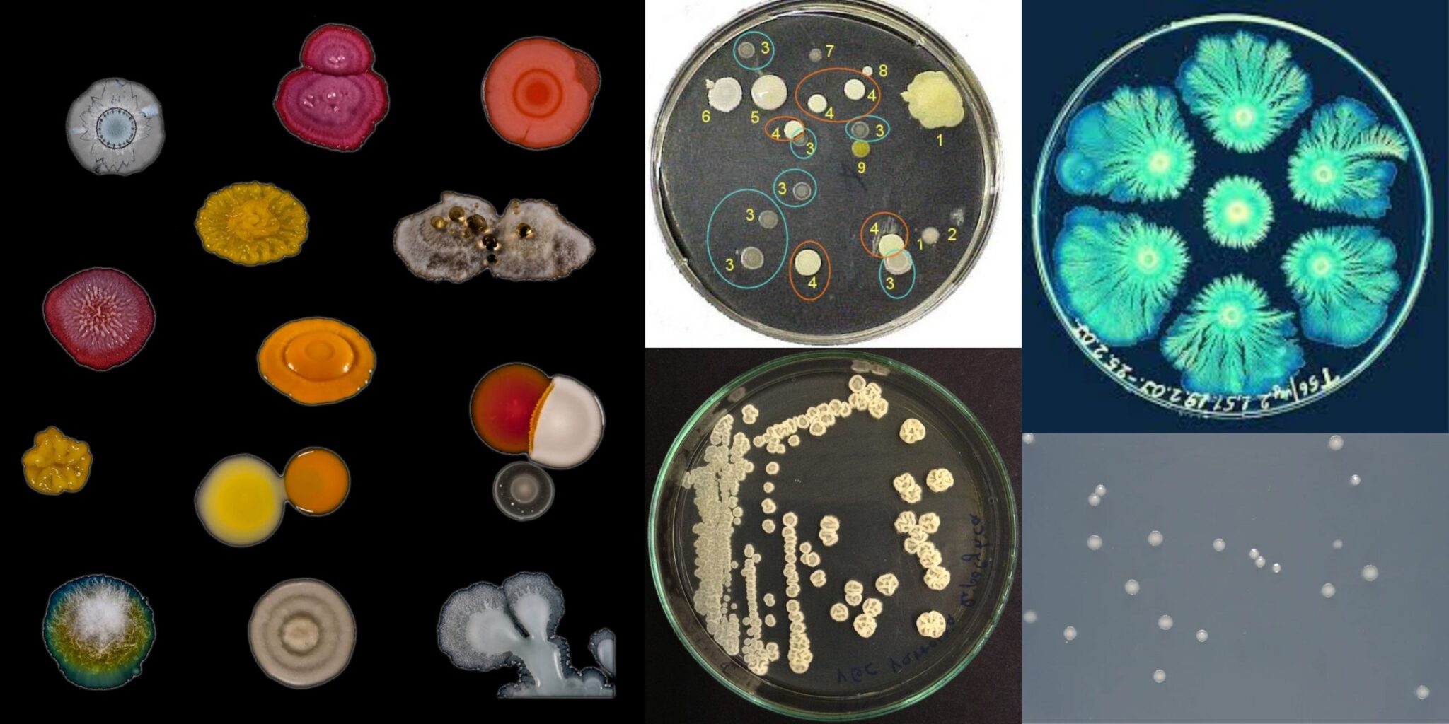 Escherichia coli(E. coli) morphology, arrangement, Cultural ...