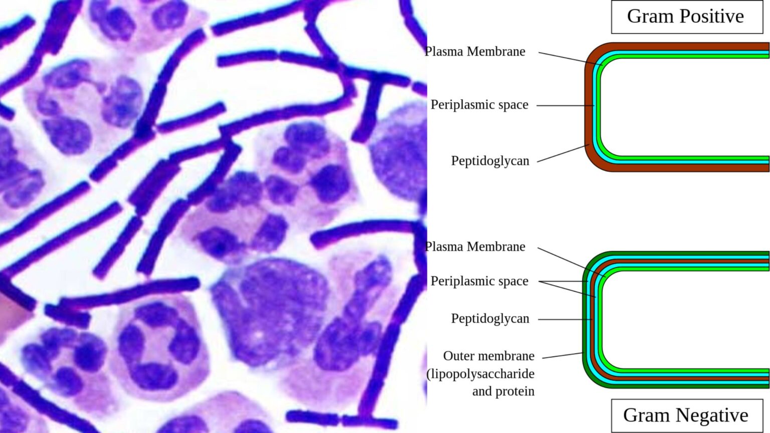 Mycobacterium leprae - Habitat, Morphology, Pathogenesis, Treatment ...