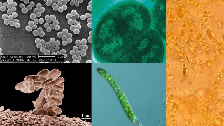 Human Skin Microbiome - Normal Flora of Skin, Hair, and Nail - Biology ...