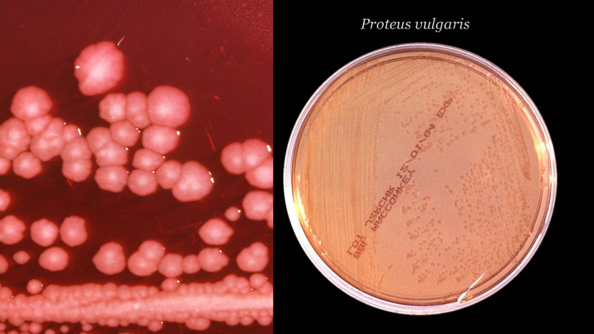 Streptococcus pyogenes - Morphology, Pathogenesis, Treatment - Biology ...