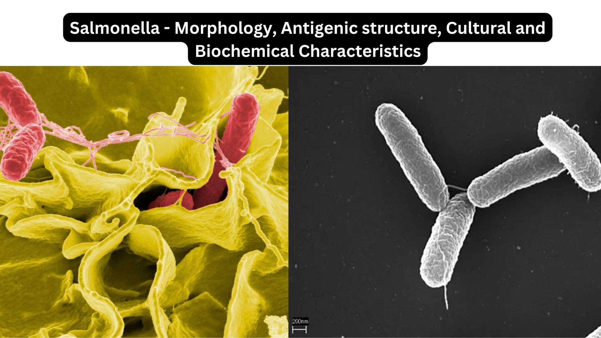 Diphtheroids - Definition, Classification, Structure, Pathogenesis ...