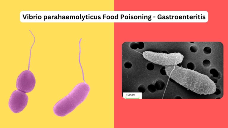 Salmonella - Morphology, Antigenic structure, Cultural and Biochemical ...