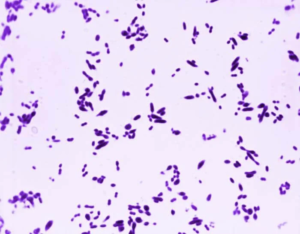 Streptococcus pneumoniae - Habitat, Morphology, Genomes - Biology Notes ...