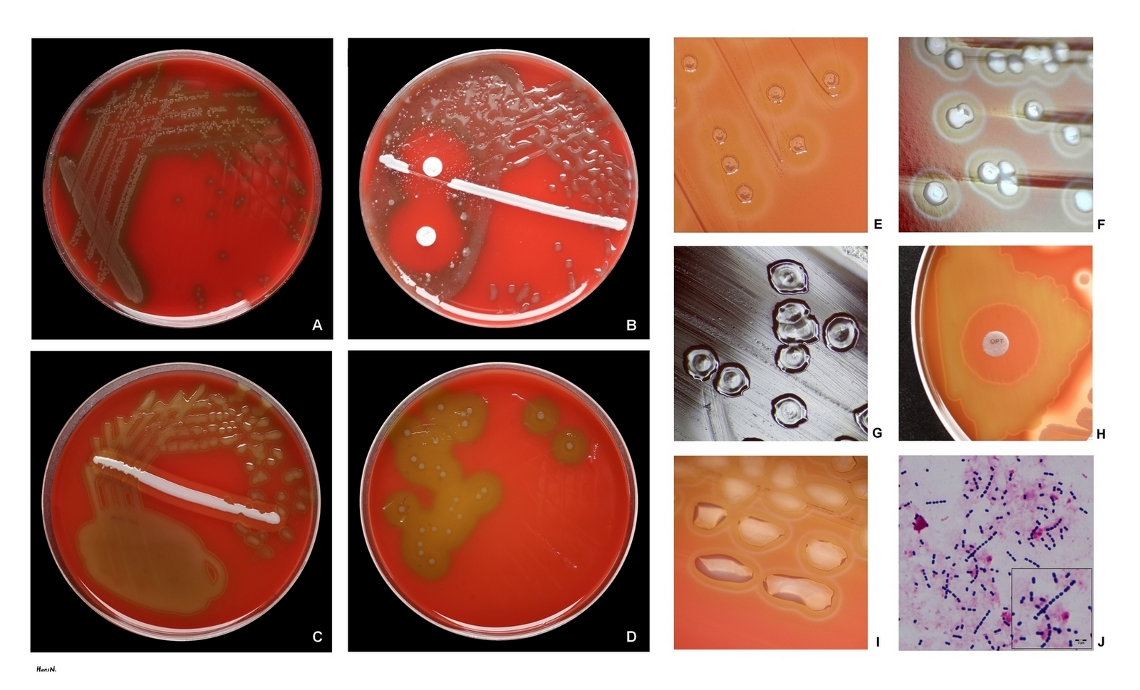 Streptococcus Pneumoniae - Habitat, Morphology, Genomes - Biology Notes ...