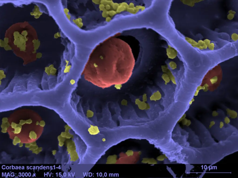 Scanning Electron Microscope - Principle, Parts, Uses - Biology Notes ...