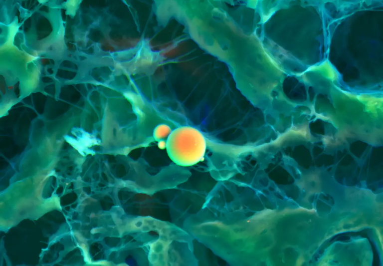 Scanning Electron Microscope - Principle, Parts, Uses - Biology Notes ...