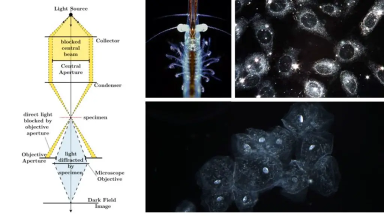 Different Types Of Microscopes With Principle, Uses, Diagrams - Biology ...