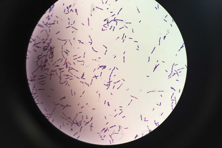 Bacillus cereus - Habitat, Morphology, Pathogenicity, Virulence Factors ...