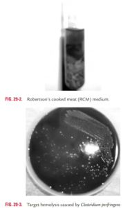 Clostridium perfringens - Habitat, Morphology, Pathogenesis, Treatment ...
