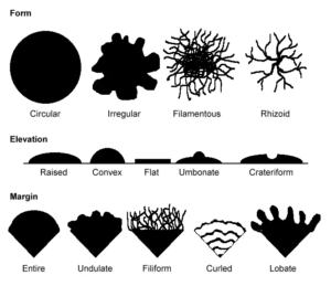 Colony Morphology of Bacteria with their identification and Examples ...