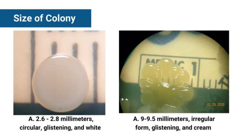 Colony Morphology of Bacteria with their identification and Examples ...