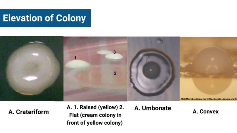 Colony Morphology of Bacteria with their identification and Examples ...