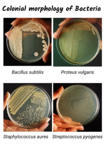 Colony Morphology of Bacteria with their identification and Examples ...
