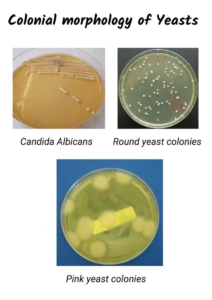 Colony Morphology of Bacteria with their identification and Examples ...