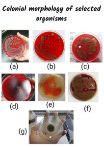 Colony Morphology of Bacteria with their identification and Examples ...