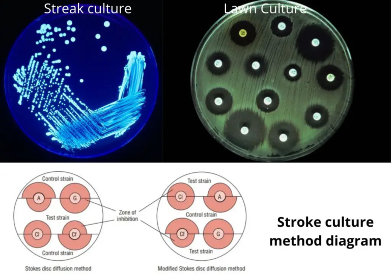 Cultivation of bacteria - Biology Notes Online