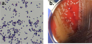 Diphtheroids - Definition, Classification, Structure, Pathogenesis ...