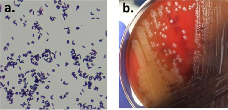 Diphtheroids - Definition, Classification, Structure, Pathogenesis ...