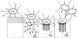Enteropathogenic Escherichia coli (EPEC) - Diseases, Toxins, Mode of ...