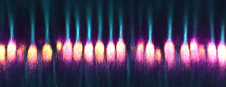 Confocal Microscope - Principle, Parts, Uses - Biology Notes Online