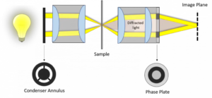 Phase Contrast Microscopy- Principle, Parts, Uses - Biology Notes Online