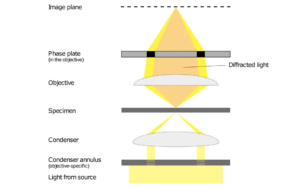 Phase Contrast Microscopy- Principle, Parts, Uses - Biology Notes Online