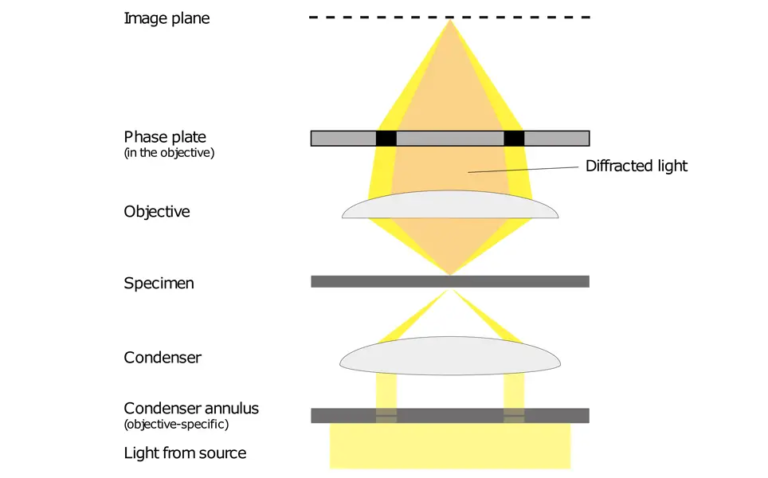 Phase Contrast Microscopy- Principle, Parts, Uses - Biology Notes Online