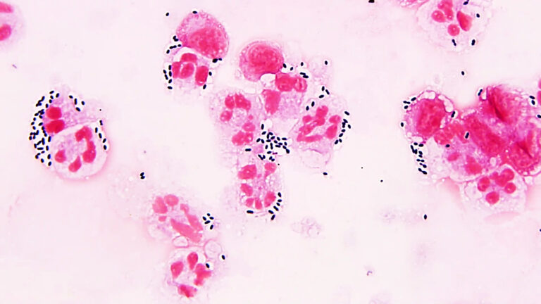 Streptococcus pneumoniae - Habitat, Morphology, Genomes - Biology Notes ...
