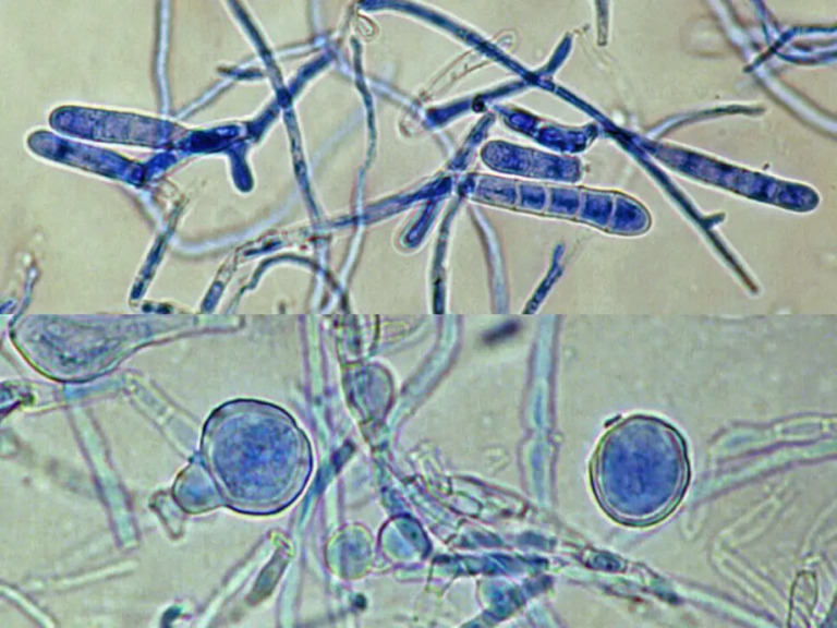 Epidermophyton floccosum - Biology Notes Online