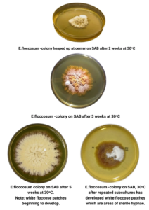 Epidermophyton floccosum - Biology Notes Online