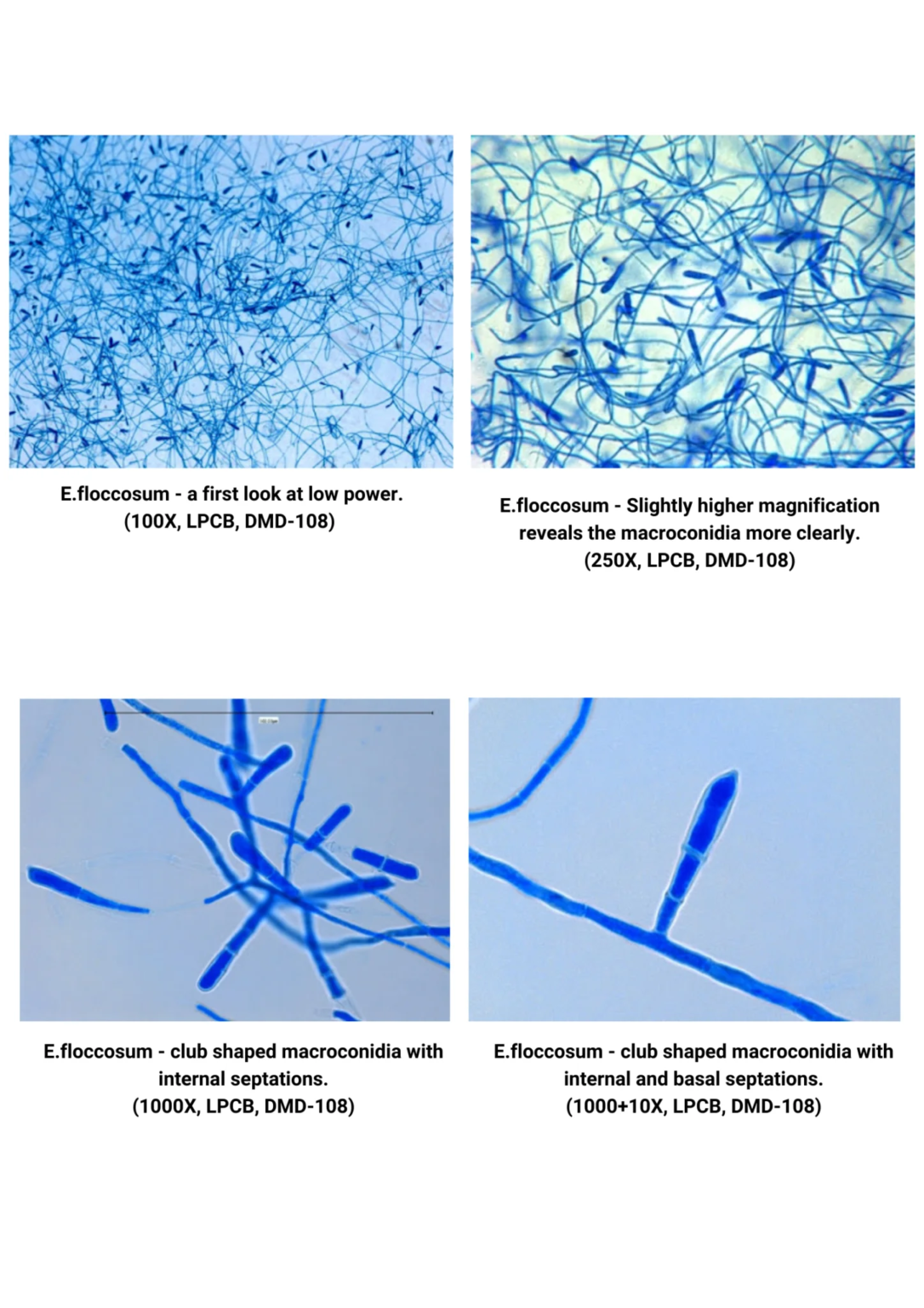Epidermophyton floccosum - Biology Notes Online