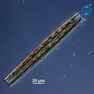 Diatoms - Definition, Structure, Life Cycle, Importance - Biology Notes ...