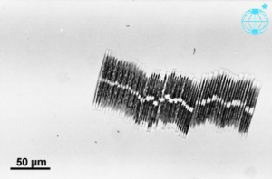 Diatoms - Definition, Structure, Life Cycle, Importance - Biology Notes ...