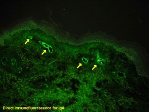 Immunofluorescence Assay - Principle, Protocol, Types, Uses - Biology ...