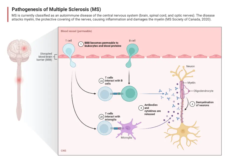 Autoimmunity - Definition, Types, Tolerance, Pathogenesis, Mechanisms ...