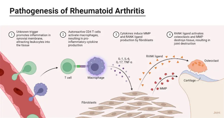 Autoimmunity - Definition, Types, Tolerance, Pathogenesis, Mechanisms ...