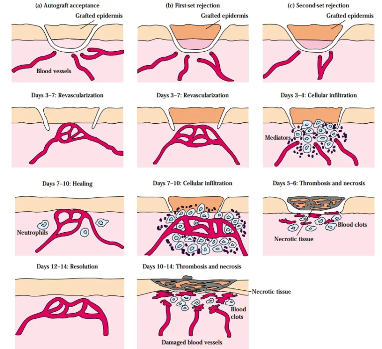 Transplantation - Definition, Types, Examples - Biology Notes Online